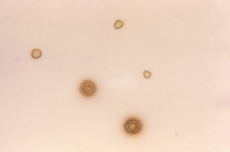 Mycoplasma | Concise Medical Knowledge