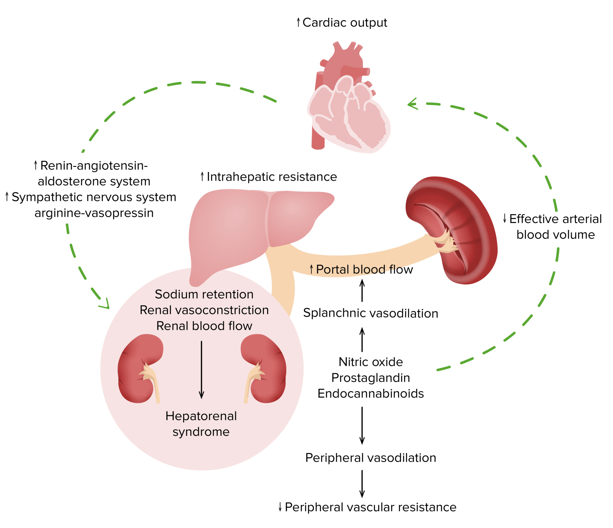 Síndrome Hepatorrenal | Concise Medical Knowledge