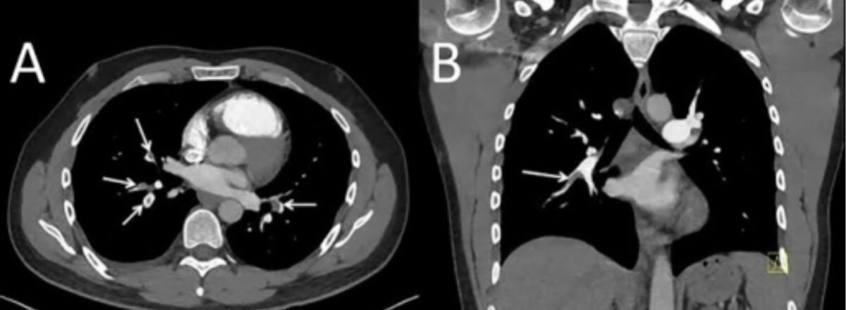 Imaging of the Lungs and Pleura | Concise Medical Knowledge