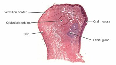 Lábios e Língua: Anatomia | Concise Medical Knowledge
