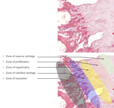 Bones: Development and Ossification | Concise Medical Knowledge