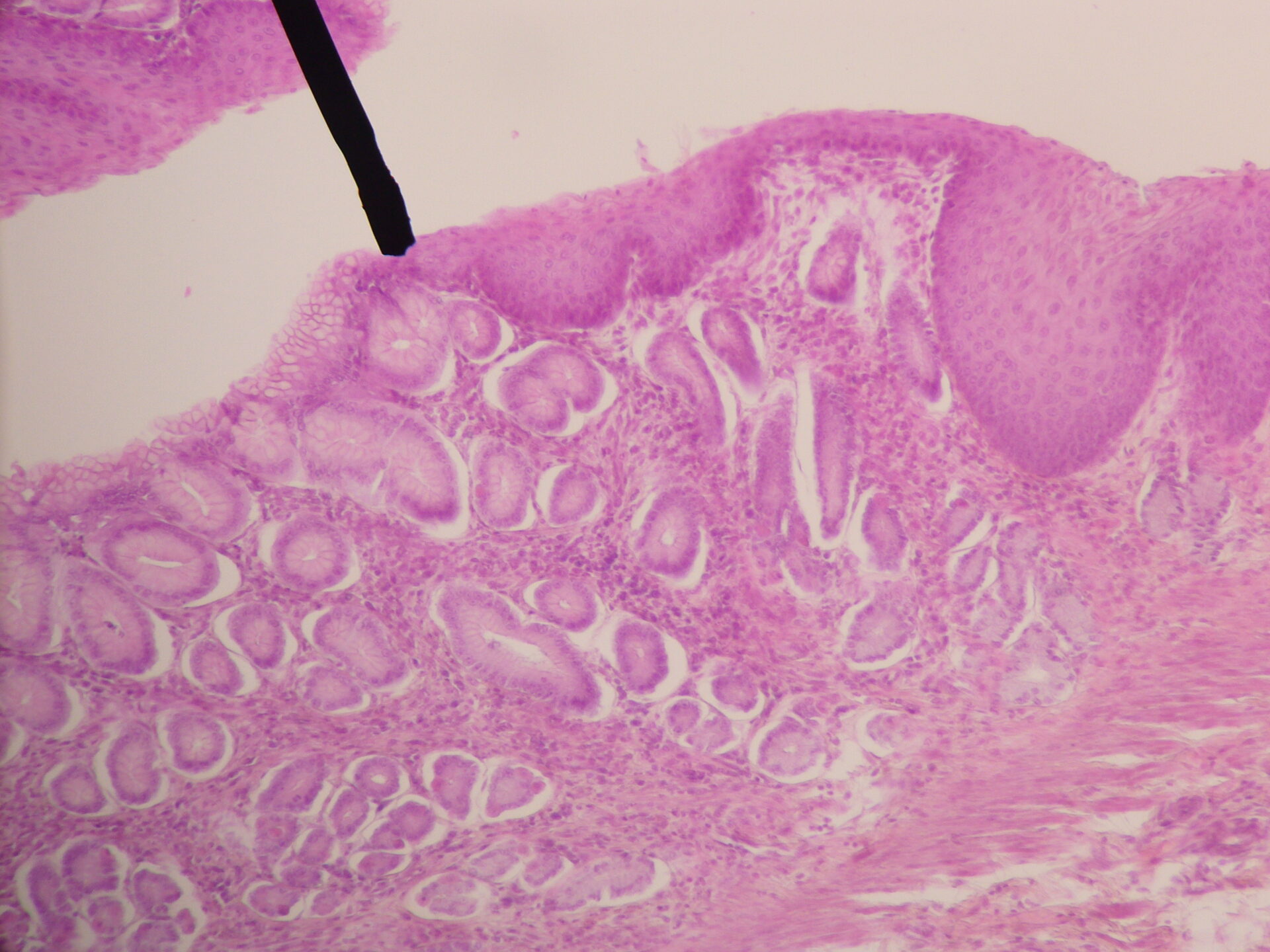 Esophagus: Anatomy | Concise Medical Knowledge