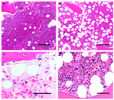 Bone Marrow: Composition and Hematopoiesis | Concise Medical Knowledge