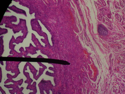 Uterus, Cervix, and Fallopian Tubes: Anatomy | Concise Medical Knowledge