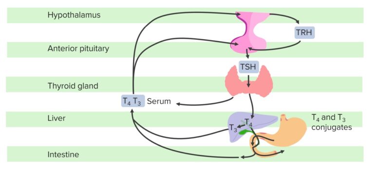 Hypothyroidism | Concise Medical Knowledge