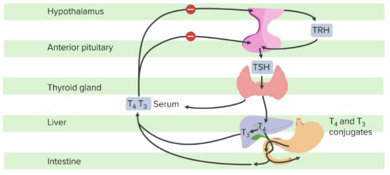 Hashimoto Thyroiditis (Clinical) | Concise Medical Knowledge
