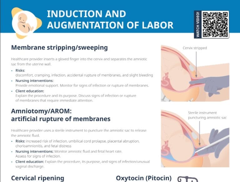 Induction/Augmentation of Labor [+ Cheat Sheet] | Lecturio