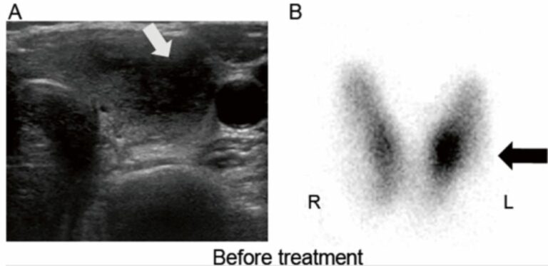 Nuclear Imaging | Concise Medical Knowledge