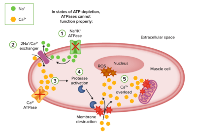 Rhabdomyolysis (Clinical) | Concise Medical Knowledge