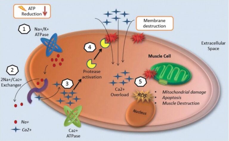 Rhabdomyolysis | Concise Medical Knowledge