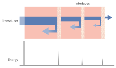Ultrasonido (Ecografía) | Concise Medical Knowledge