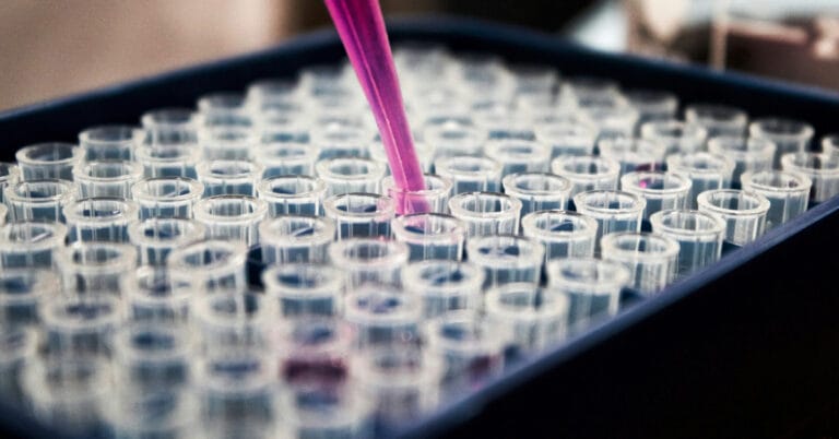 Immunodiagnostics: Introduction and Methods | Lecturio