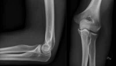 Rayos X | Concise Medical Knowledge