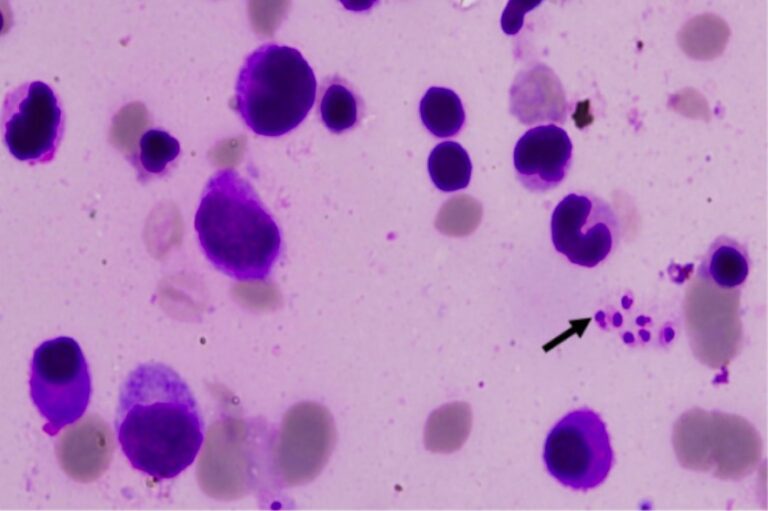 Leishmania/Leishmaniasis | Concise Medical Knowledge