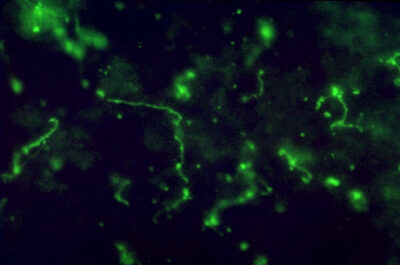 Leptospira/Leptospirosis | Concise Medical Knowledge