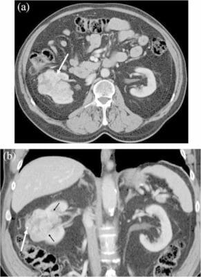 Imaging of the Urinary System | Concise Medical Knowledge