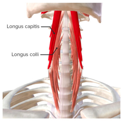 Neck Muscles: Anatomy & Groups | Concise Medical Knowledge