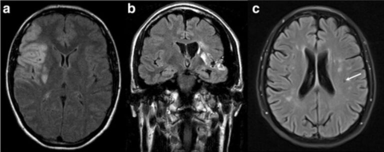 Magnetic Resonance Imaging (MRI) | Concise Medical Knowledge