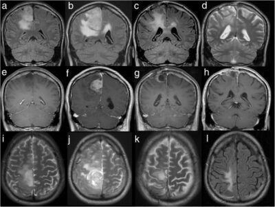 Magnetic Resonance Imaging (MRI) | Concise Medical Knowledge