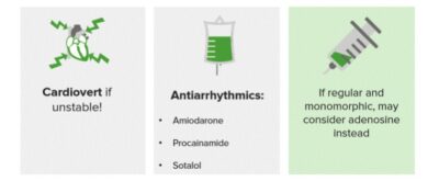 Ventricular Tachycardia | Concise Medical Knowledge
