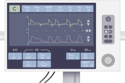 Invasive Mechanical Ventilation | Concise Medical Knowledge