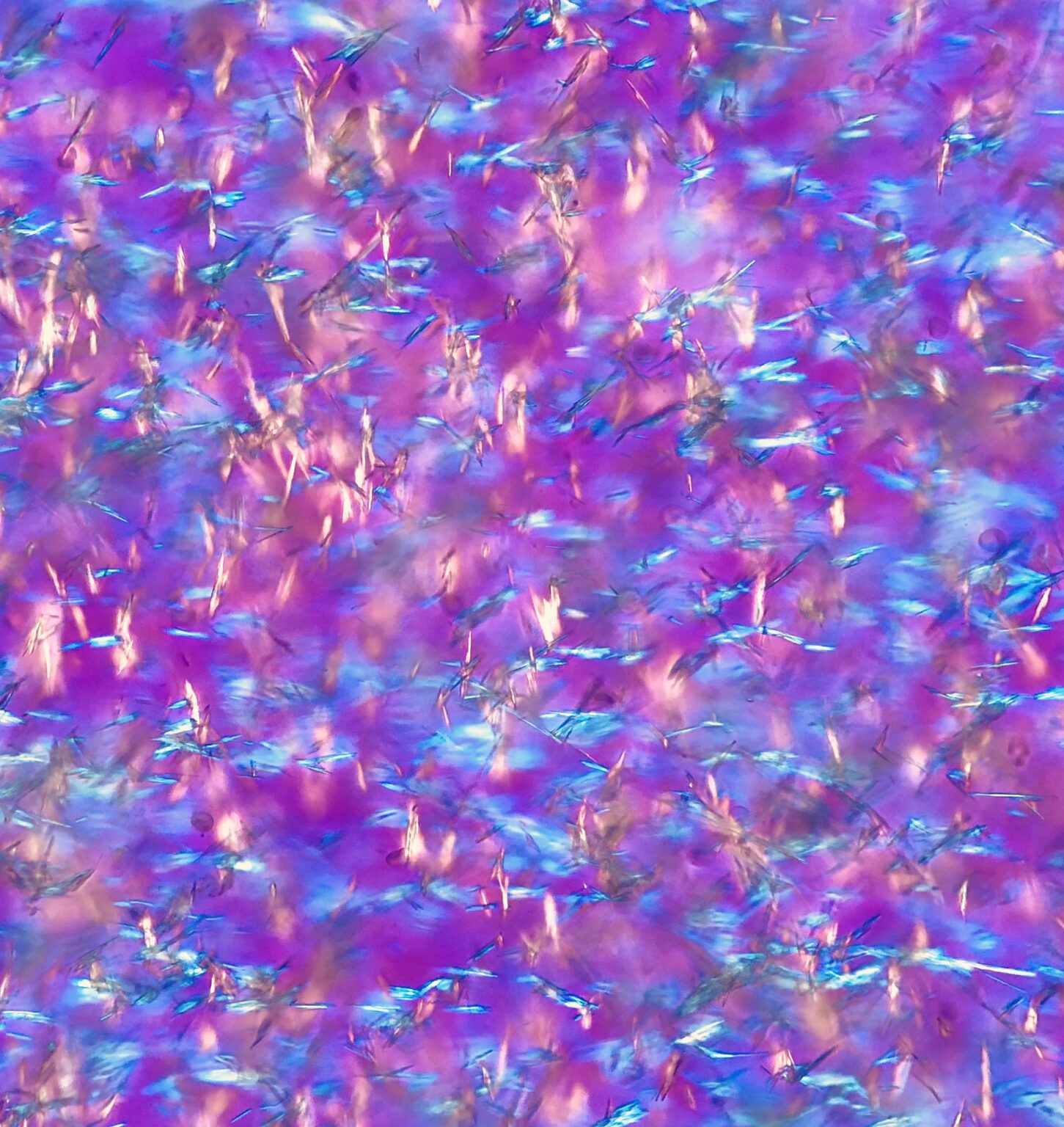 Gota | Concise Medical Knowledge