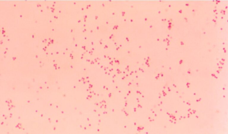 Moraxella | Concise Medical Knowledge