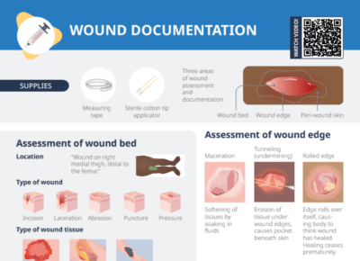 Wound Documentation Free Cheat Sheet Lecturio