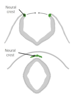 Development of the Nervous System and Face | Concise Medical Knowledge