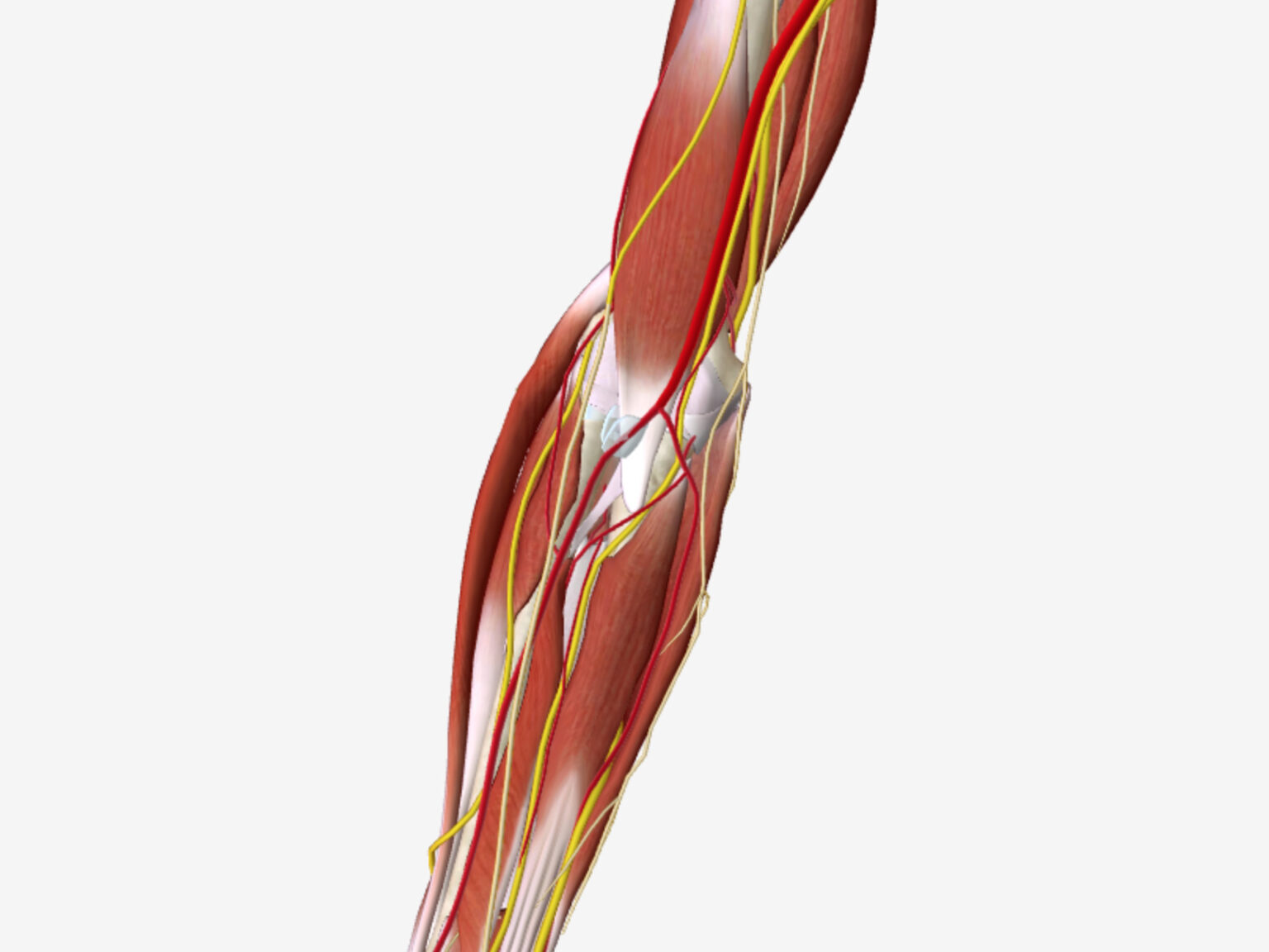 Supracondylar Fracture | Concise Medical Knowledge
