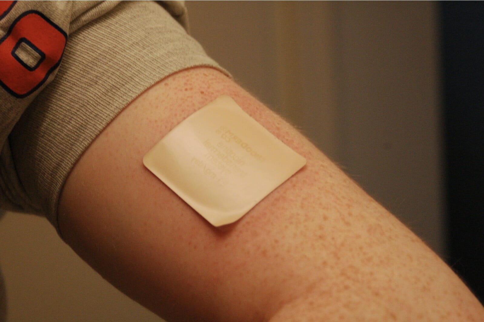 Transdermal Medication Patch [+ Free Cheat Sheet] | Lecturio