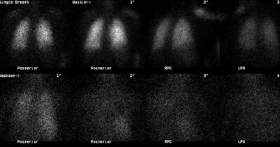 Nuclear Imaging | Concise Medical Knowledge