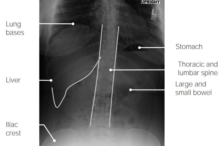 Imaging of the Intestines | Concise Medical Knowledge