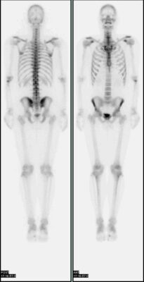Imagenología Nuclear | Concise Medical Knowledge
