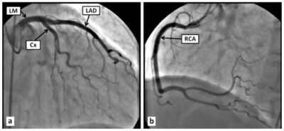 Imaging of the Heart and Great Vessels | Concise Medical Knowledge