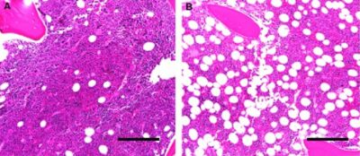 Primary Lymphatic Organs | Concise Medical Knowledge