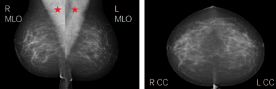 Imaging of the Breast | Concise Medical Knowledge