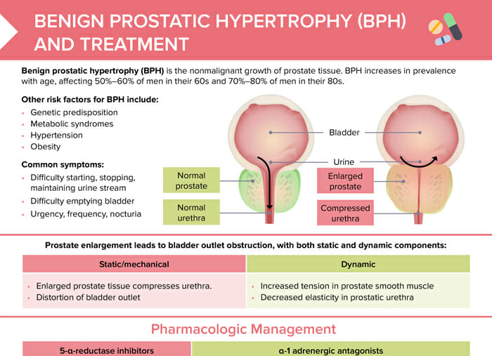 BPH Nursing Diagnosis Free Cheat Sheet Lecturio BPH Nursing Diagnosis Free Cheat Sheet Lecturio