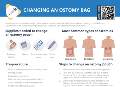 How to Change an Ostomy Bag [+ Free Cheat Sheet] | Lecturio