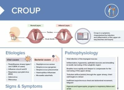 Croup vs Whooping Cough [+ Free Cheat Sheet] | Lecturio