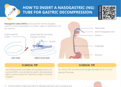 NG Tube Placement [+ Free Cheat Sheet] | Lecturio Nursing