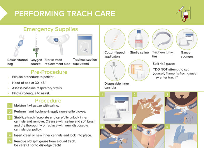 Trach Care Steps Free Sheet Lecturio Nursing