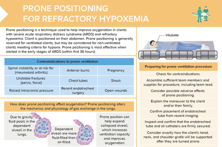 Prone Position for Hypoxemia [+ Free Cheat Sheet] | Lecturio