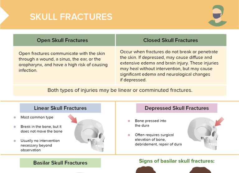 Types of Fractures [+ Free Cheat Sheet] | Lecturio Nursing