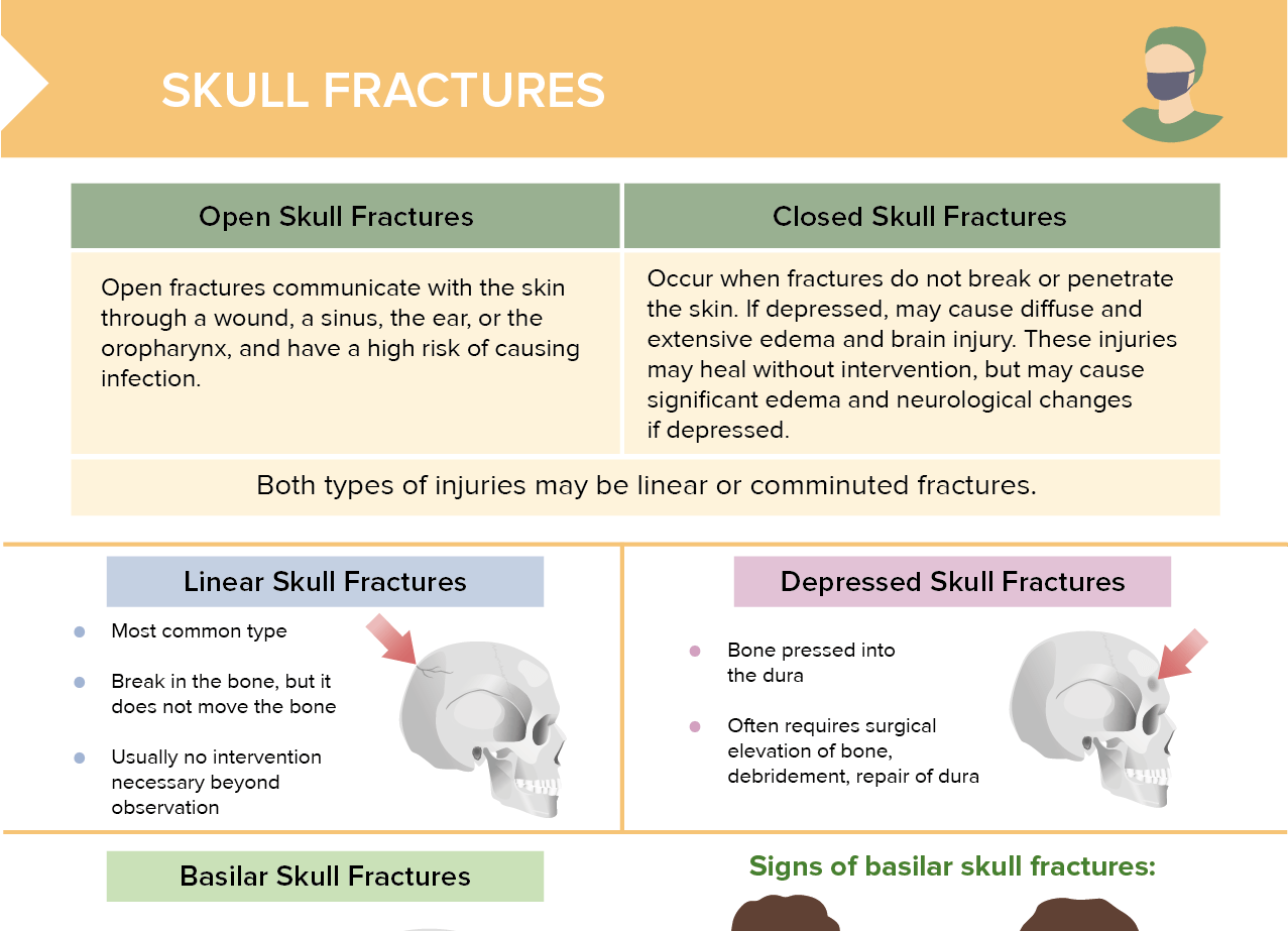 Types Of Skull Fracture Types Of Skull Fracture