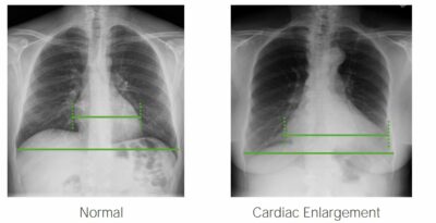 Imaging of the Heart and Great Vessels | Concise Medical Knowledge