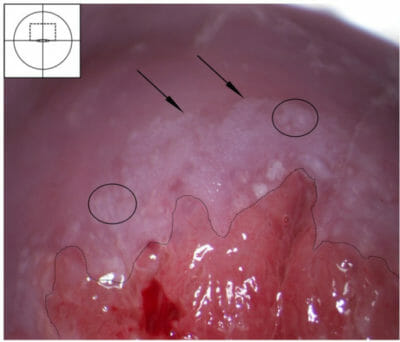 Procedimientos Diagnósticos en Ginecología | Concise Medical Knowledge