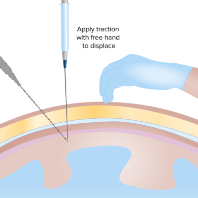 Basic Procedures | Concise Medical Knowledge