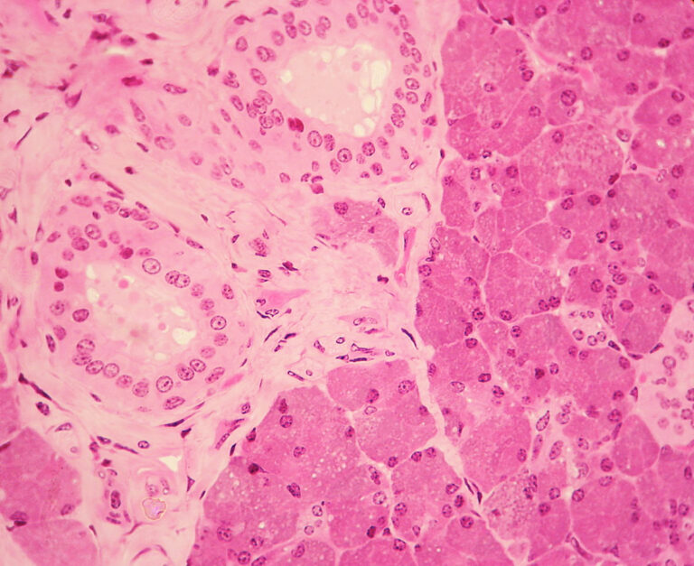 Epitelio de Superficie: Histología | Concise Medical Knowledge