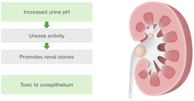 Proteus | Concise Medical Knowledge